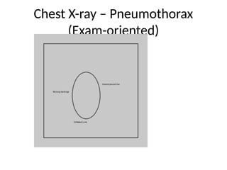Approach_to_Pneumothorax_Flowchart_Xray.pptx