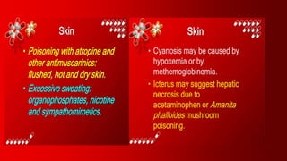Approach to poisoned patient.pptx