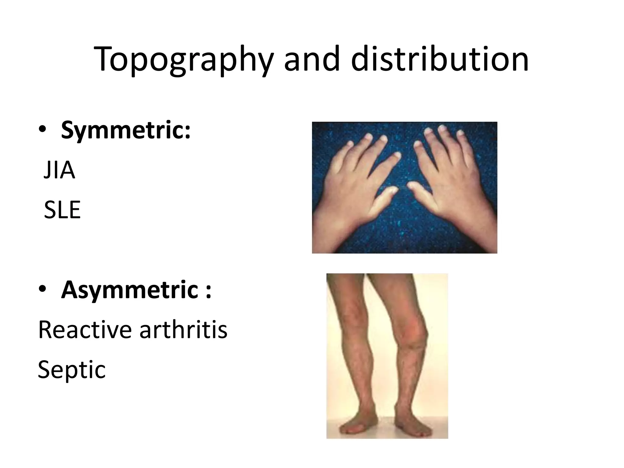 Approach to polyarthritis in children | PPTX