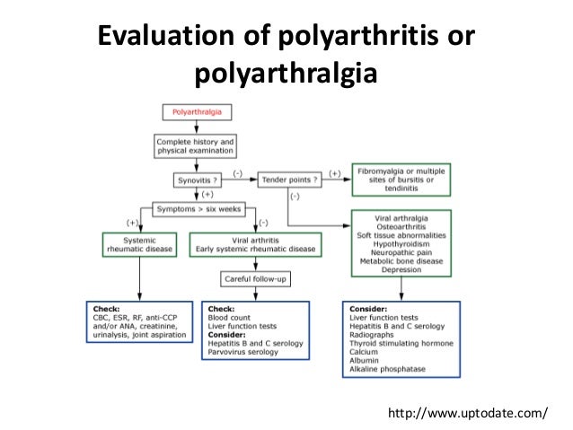 Approach to polyarthritis in children