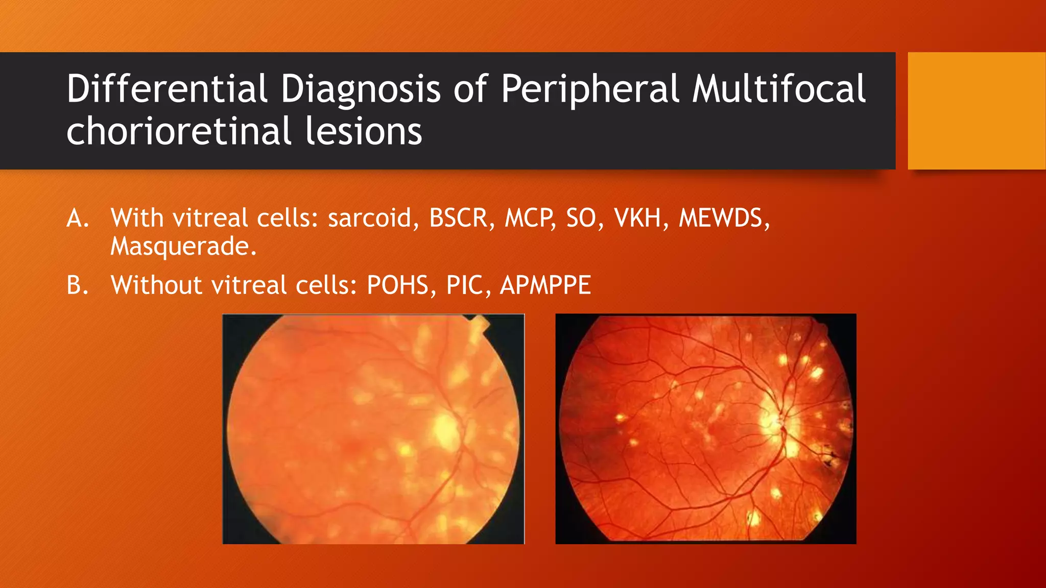 Approach to posterior uveitis final modified | PPTX