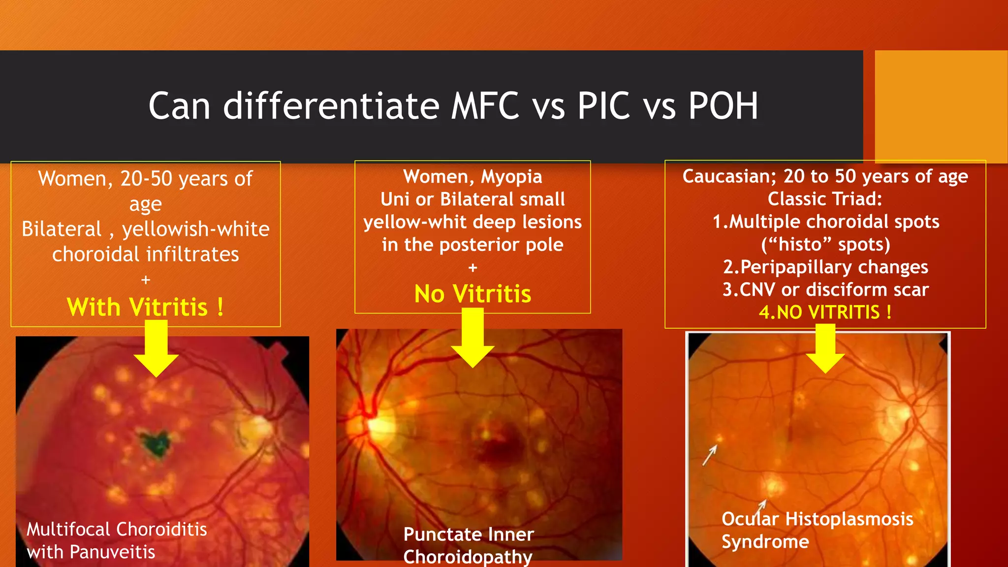 Approach to posterior uveitis final modified | PPTX