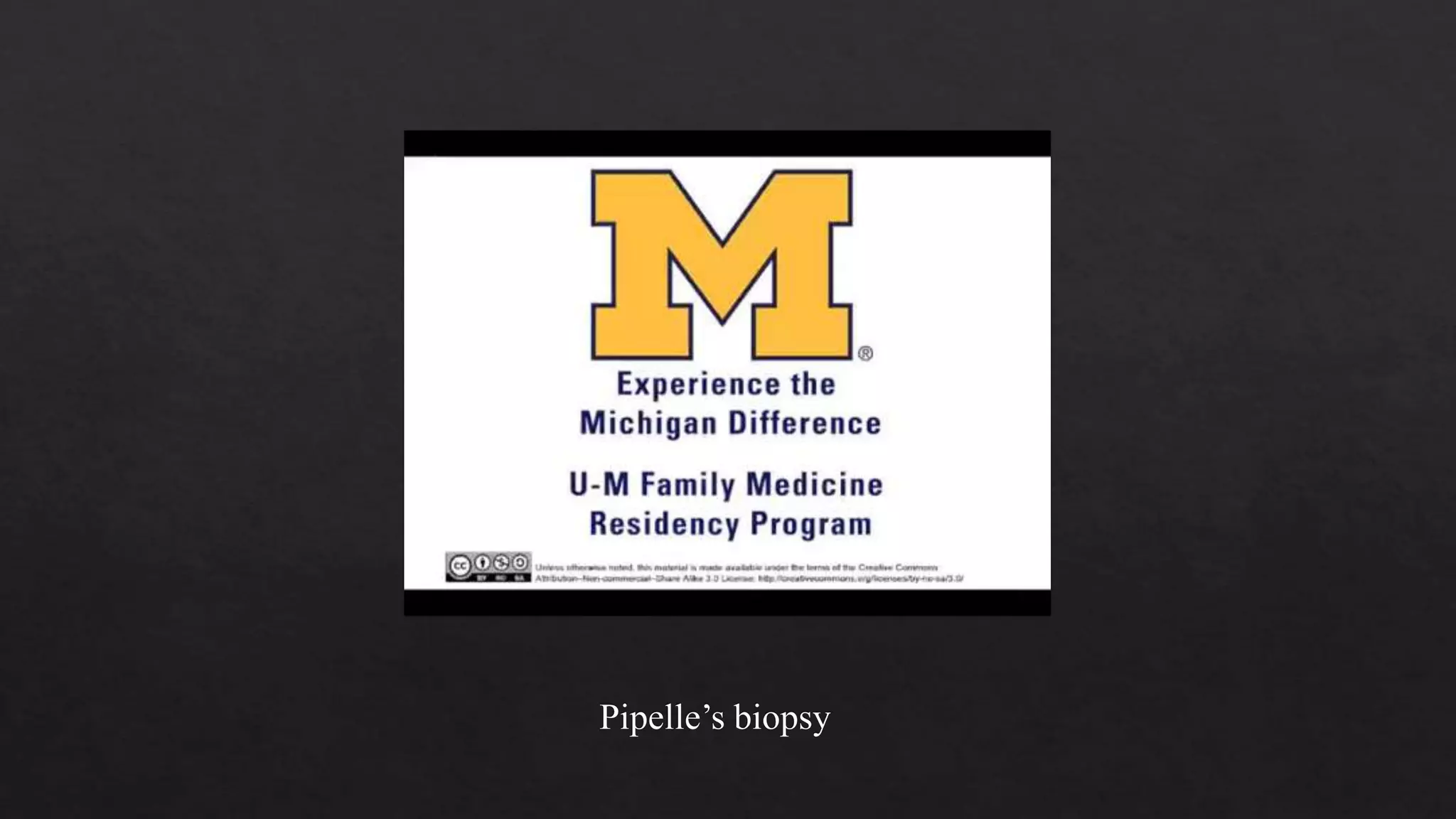 Approach to post menopausal bleeding | PPTX | Reproductive Health ...