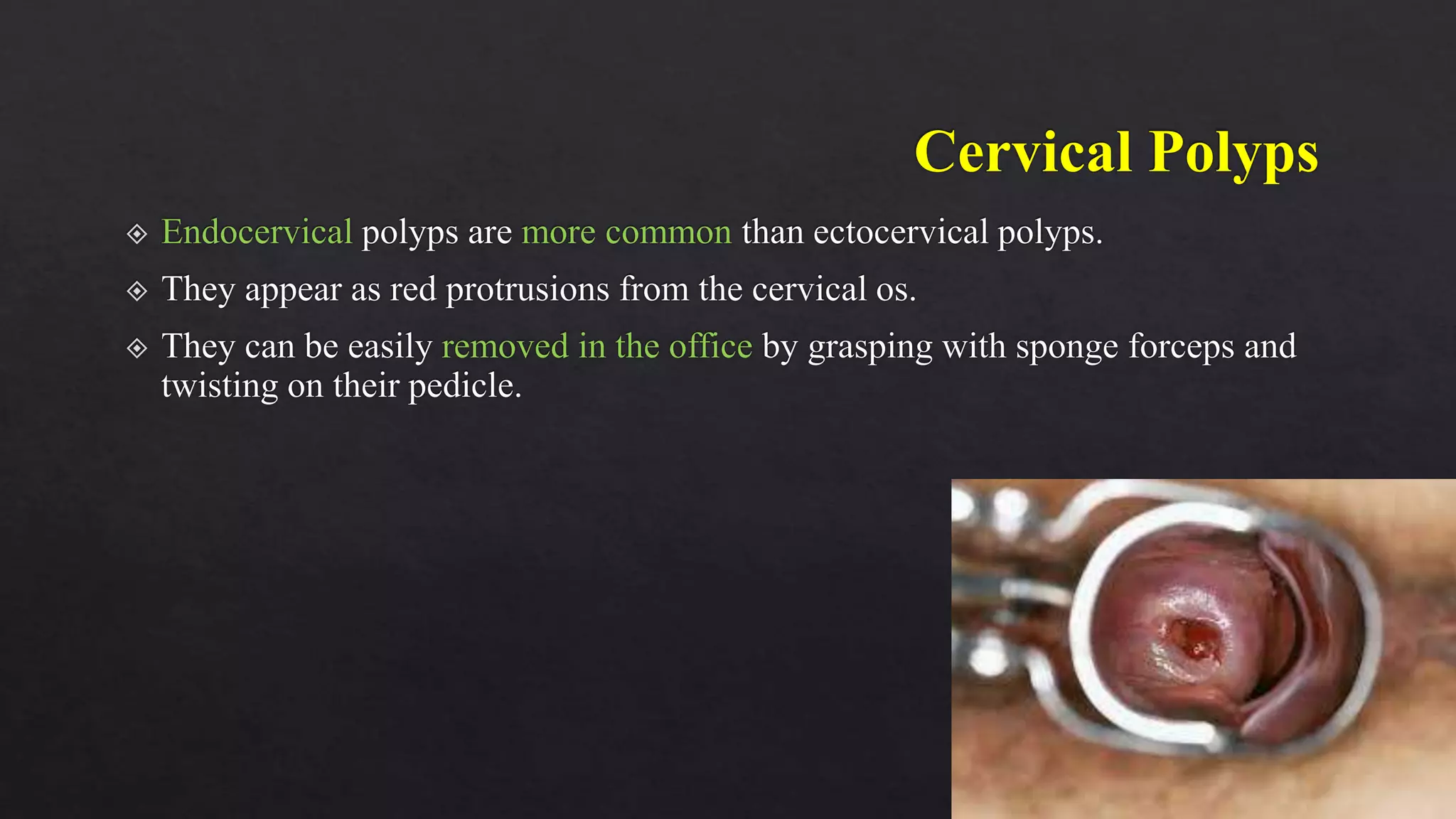 Approach to post menopausal bleeding | PPTX