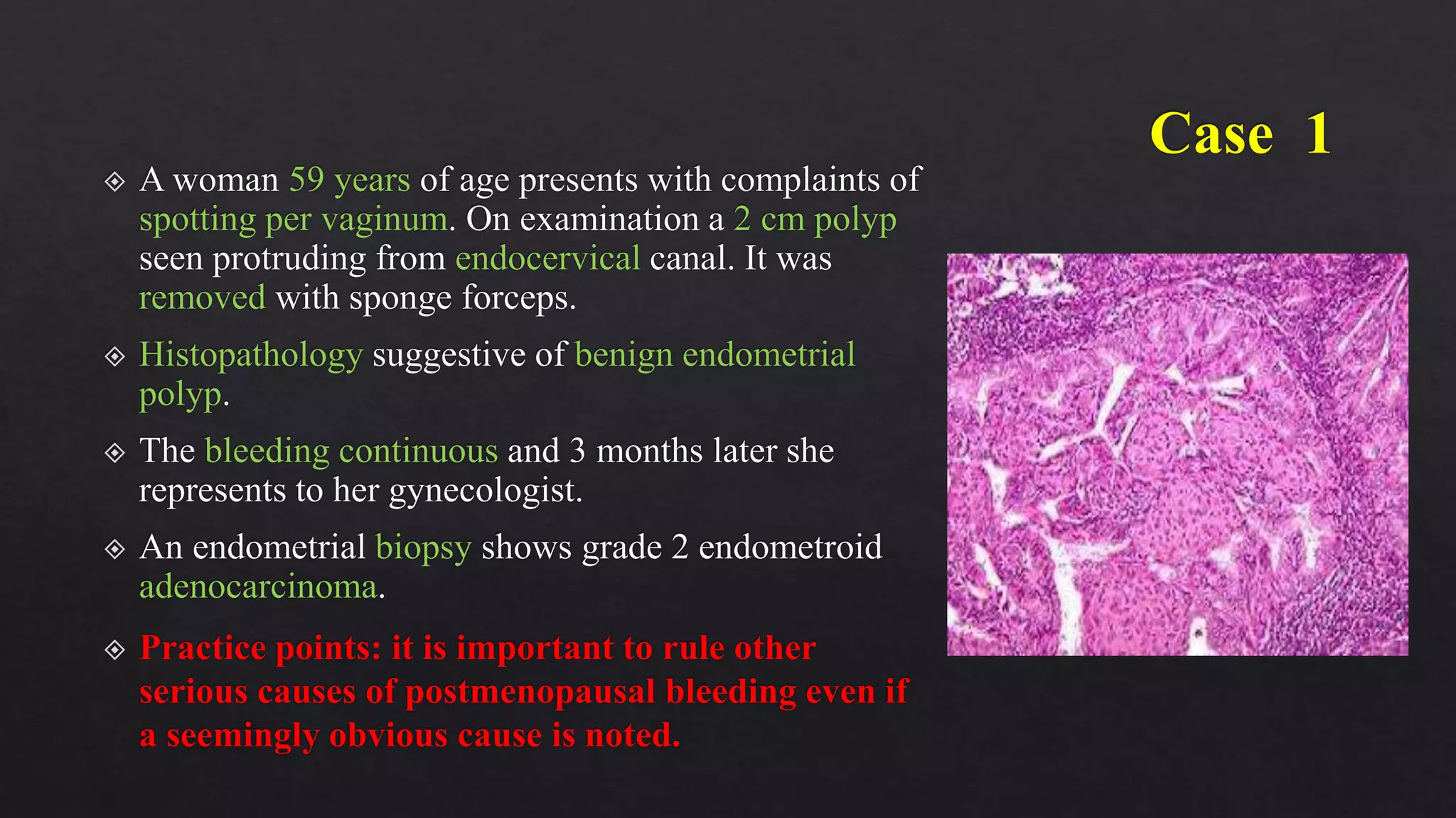 Approach to post menopausal bleeding | PPTX