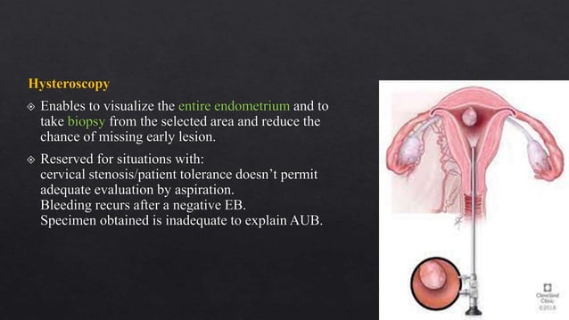 Approach to post menopausal bleeding | PPTX | Reproductive Health ...