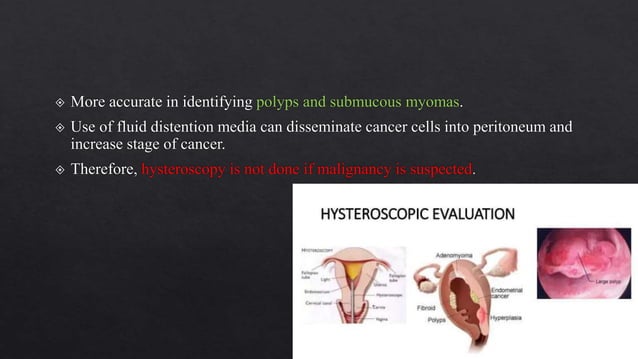 Approach to post menopausal bleeding | PPTX | Reproductive Health ...