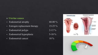 Approach to post menopausal bleeding | PPTX