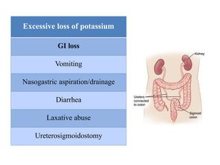 Approach to potassium disorder, causes, investigation, ecg changes ...