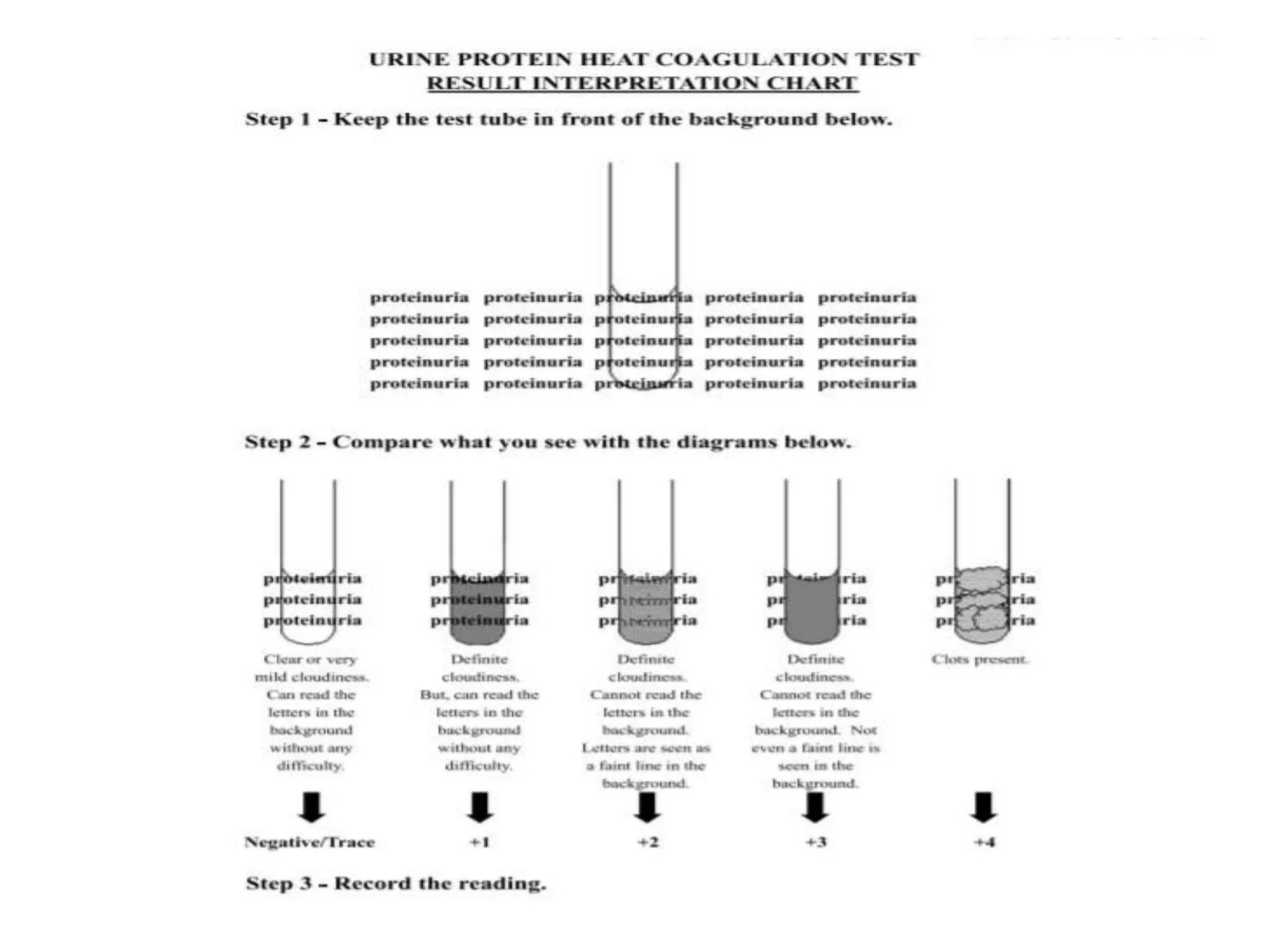 Approach to proteinuria in Children | PPT