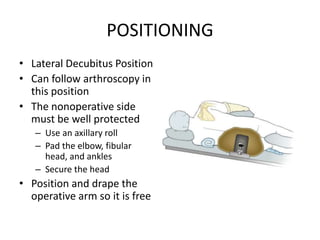 Approach to proximal arm | PPTX