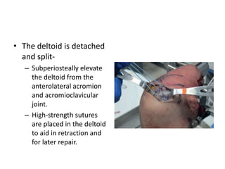 Approach to proximal arm | PPTX