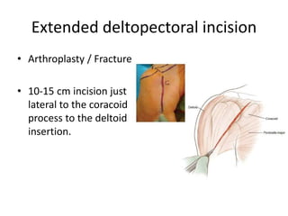 Approach to proximal arm | PPTX