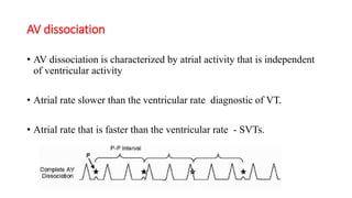 Approach to qrs wide complex tachycardias copy | PPTX