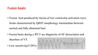 Approach to qrs wide complex tachycardias copy | PPTX