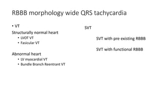 Approach to qrs wide complex tachycardias copy | PPTX