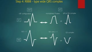 Approach to qrs wide complex tachycardias copy | PPTX