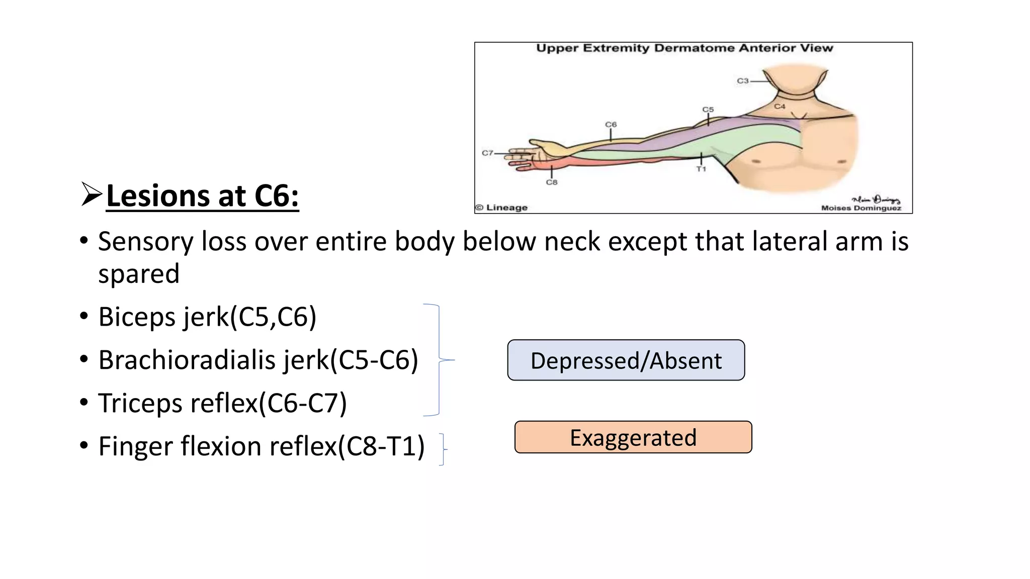 Approach to quadriparesis | PPTX