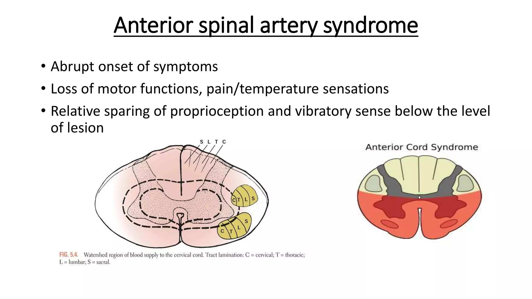 Approach to quadriparesis | PPTX