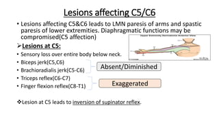 Approach to quadriparesis | PPTX