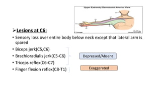 Approach to quadriparesis | PPTX