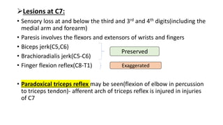 Approach to quadriparesis | PPTX