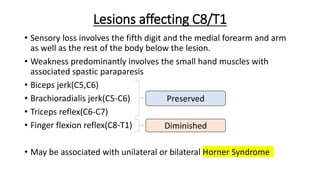Approach to quadriparesis | PPTX