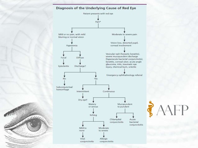 Approach to red eye | PPT