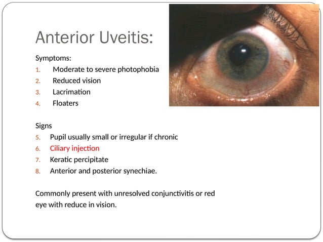 Approach to RED EYE and eye diseases pptx | PPT