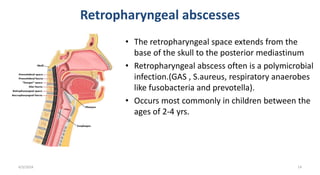 Approach to respiratory distress in children.pptx