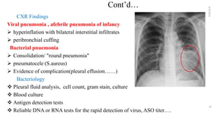 Approach to respiratory distress in children.pptx