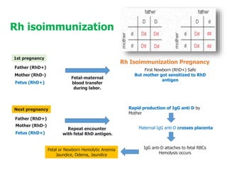 approach to Rh Isoimmunization Maternal and neonatal aspects | Dr ...