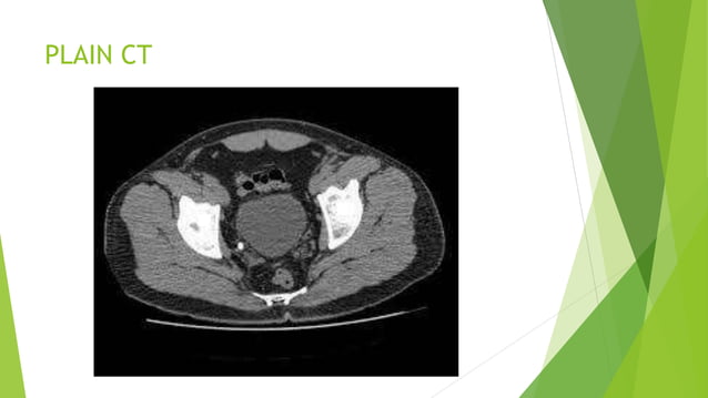 Approach to right iliac fossa(RIF) pain | PPTX | Digestive Disorders ...