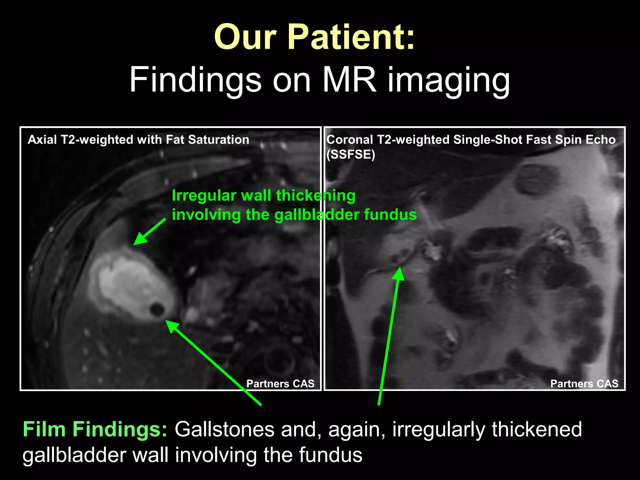 Approach to right upper quadrant pain-lessons from a case | PPT