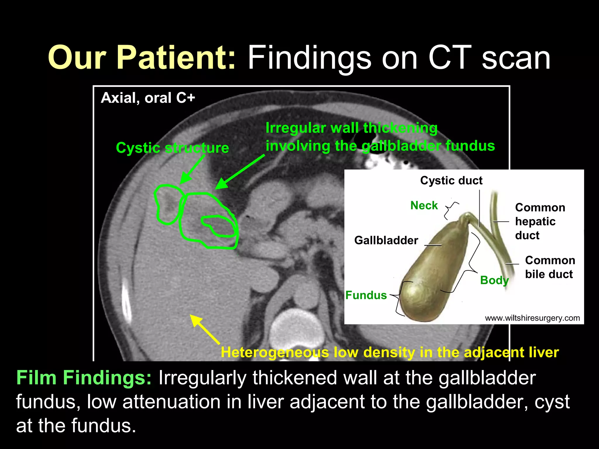 Approach to right upper quadrant pain-lessons from a case | PPT