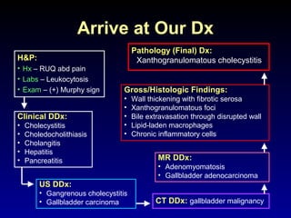 Approach to right upper quadrant pain-lessons from a case | PPT