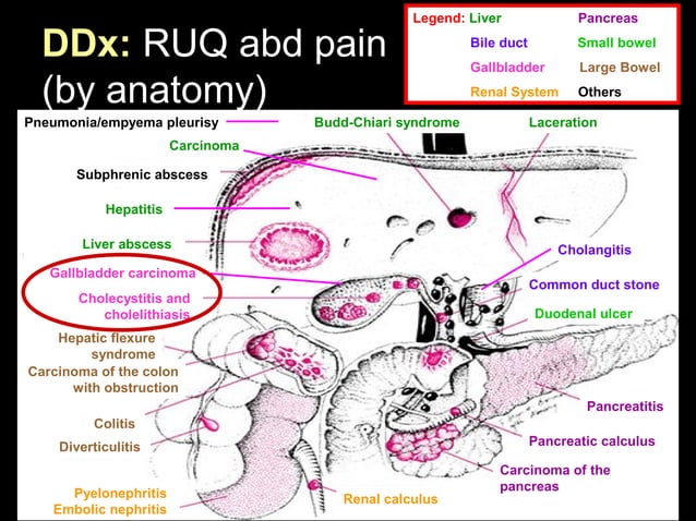 Approach to right upper quadrant pain-lessons from a case | PPT