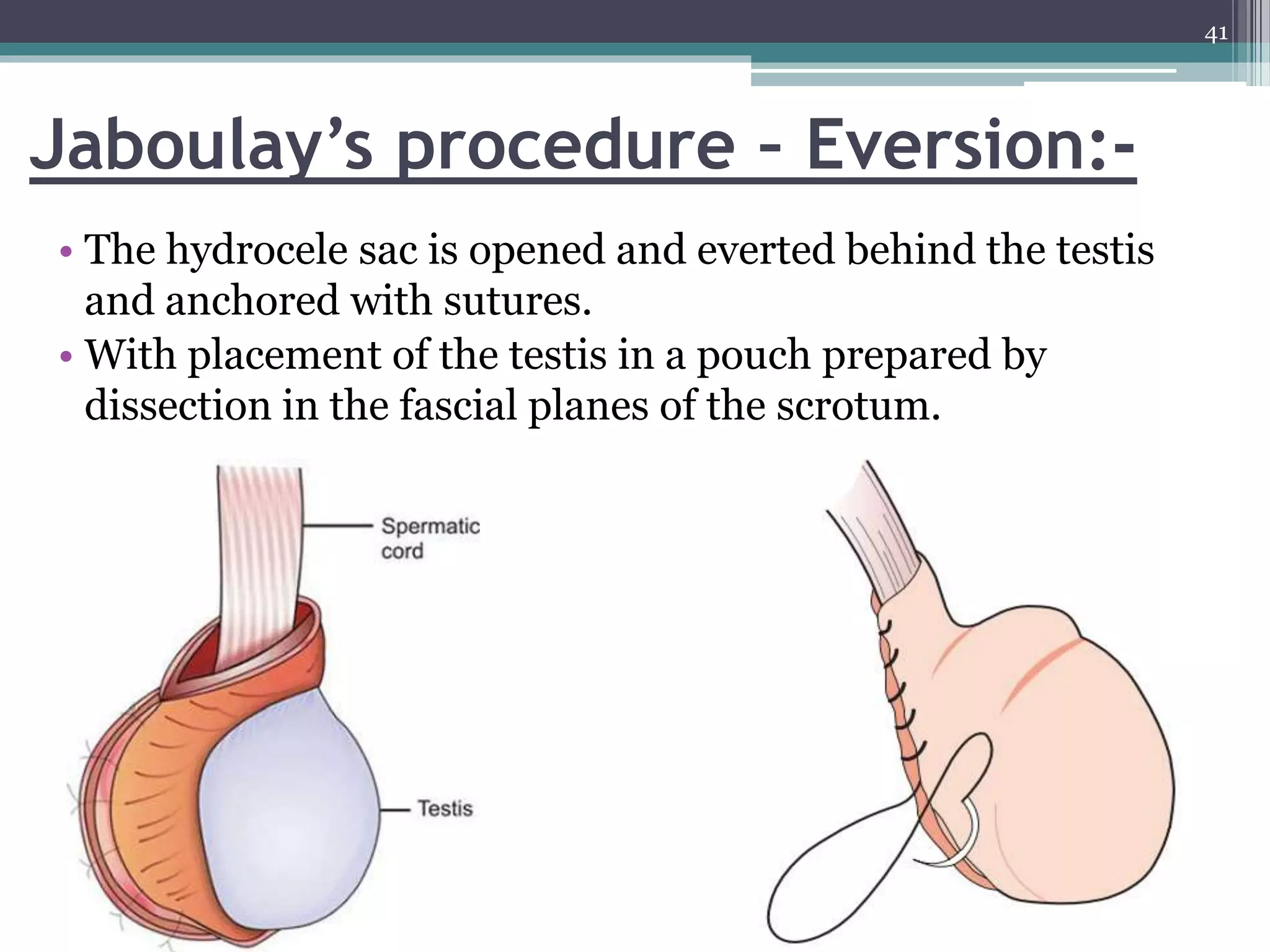 Approach to Scrotal Swelling.pptx | Infertility | Reproductive Health