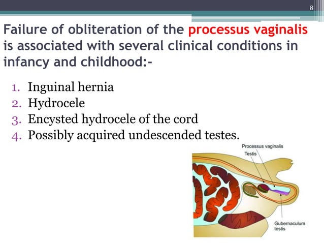 Approach to Scrotal Swelling.pptx | Infertility | Reproductive Health