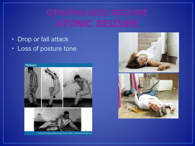 APPROACH TO SEIZURE CME | PPT