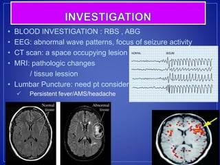 APPROACH TO SEIZURE CME | PPTX