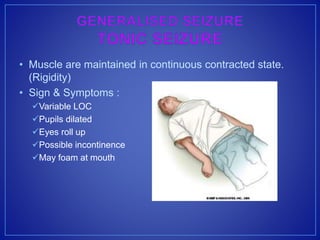 APPROACH TO SEIZURE CME | PPTX
