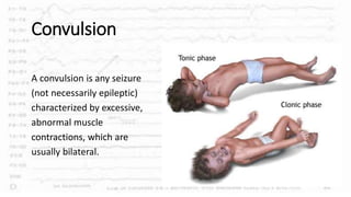 Approach to seizures in a child | PPTX