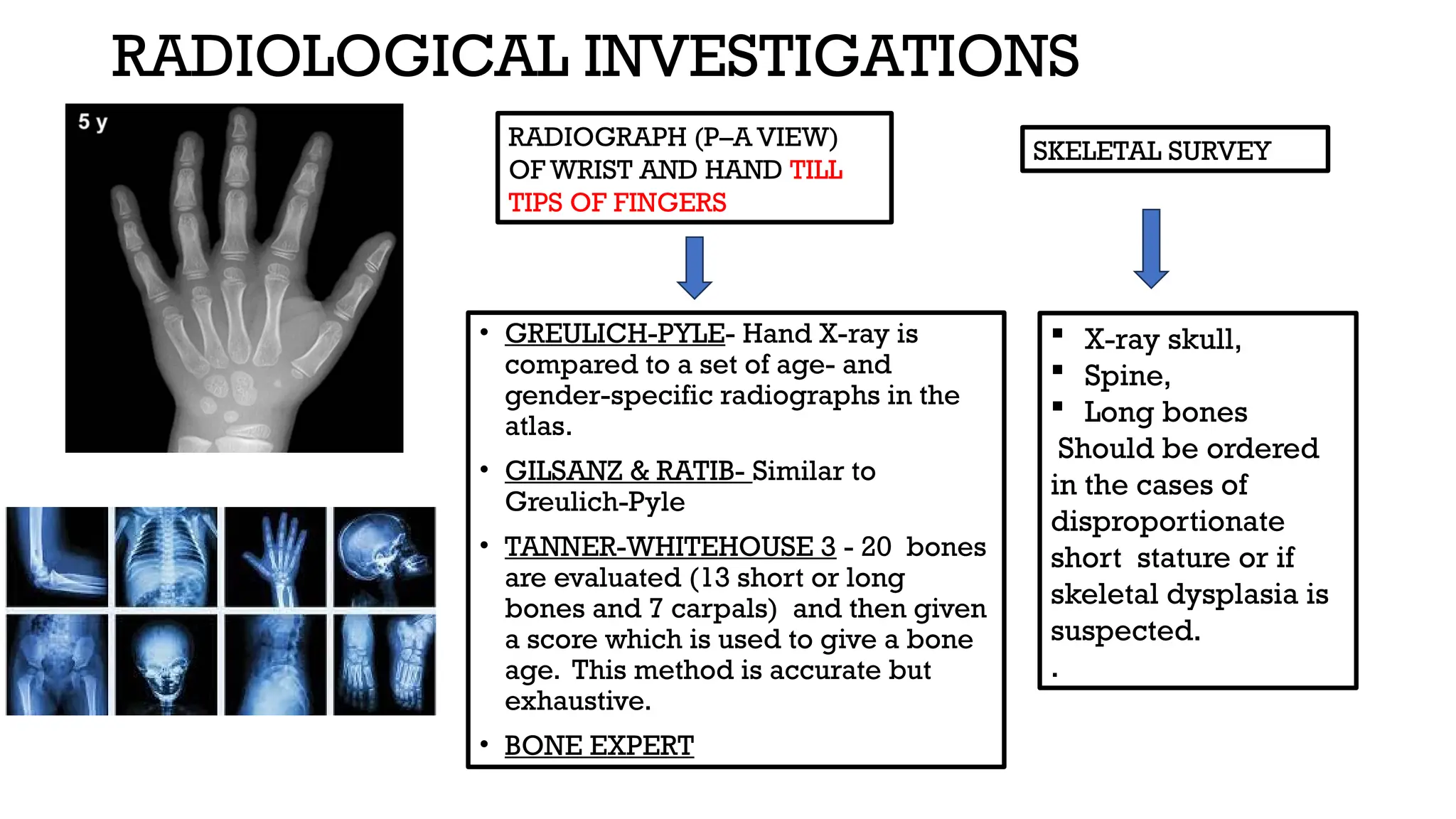 APPROACH TO SHORT STATURE in pediatrics age group | PPTX