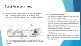 APPROACH TO SHORT STATURE presentation for medical students | PPTX