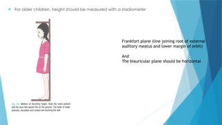 APPROACH TO SHORT STATURE presentation for medical students | PPTX