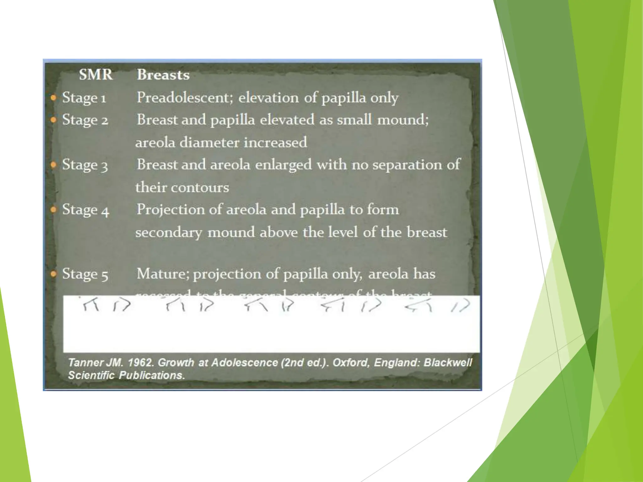 Approach to short stature ppt.pptx
