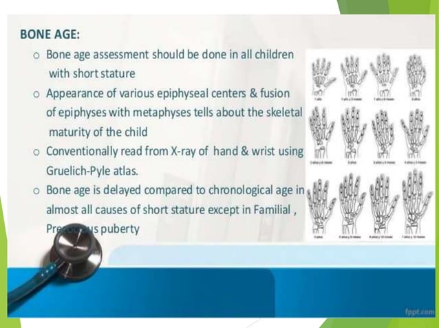 Approach to short stature ppt.pptx