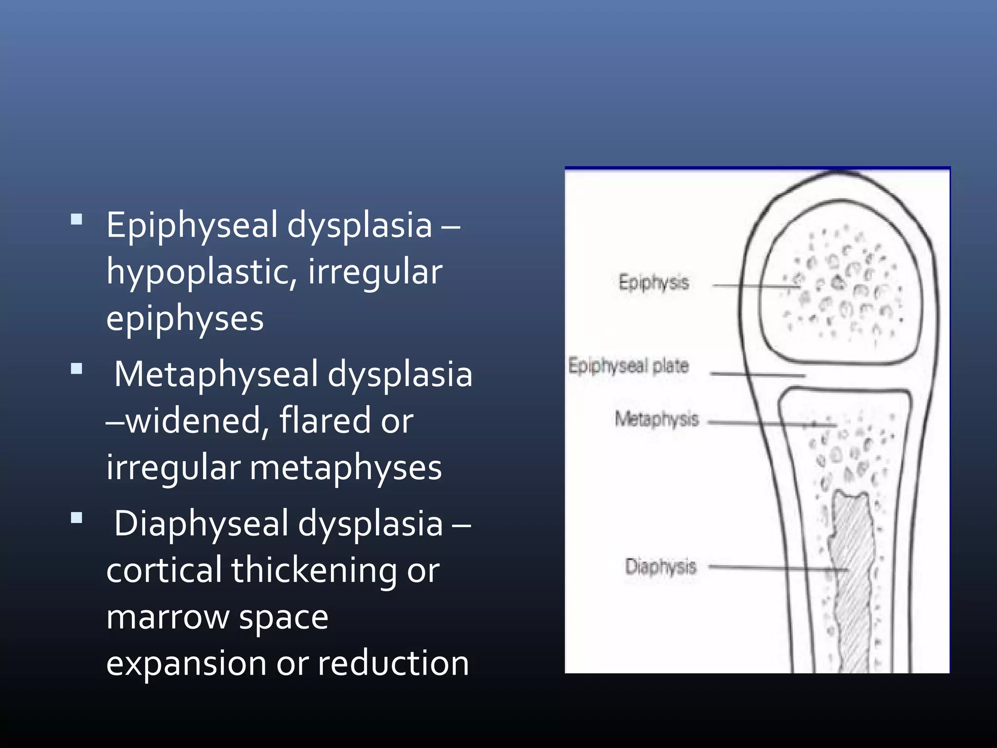 Approach to skeletal dysplasia | PPT | Bone and Joint Conditions ...