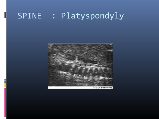 Approach to skeletal dysplasia | PPT | Bone and Joint Conditions ...